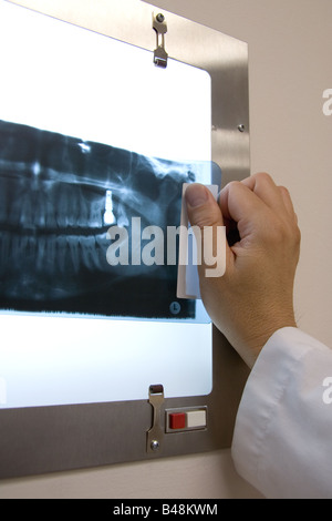 Doctor checking panoramic x-ray Stock Photo - Alamy
