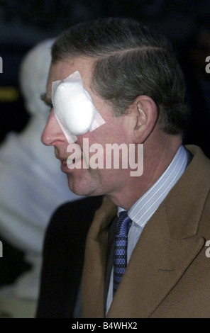 Prince Charles Eye Patch Stock Photo: 106746664 - Alamy