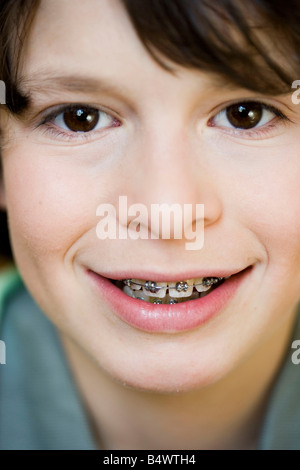 close portrait of Caucasian boy with braces and reassuring smile in ...