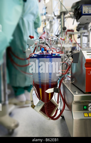 The operating theatre during heart bypass operation at the London chest ...