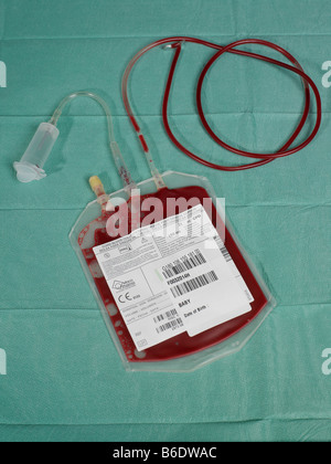 Harvesting umbilical cord stem cells Midwife collecting blood from an ...