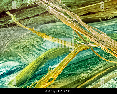 Tendon, coloured scanning electron micrograph (SEM), showing bundles of ...