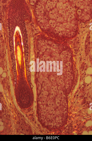 Hair follicle sebaceous gland, light micrograph Stock Photo - Alamy