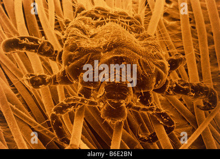 Pubic louse. Coloured scanning electron micrograph (SEM) of a pubic ...