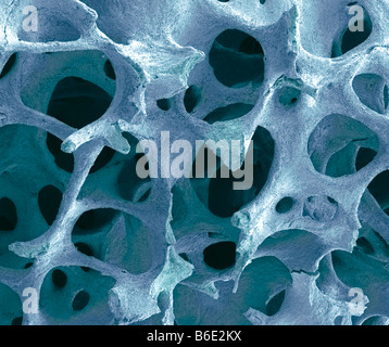 Bone tissue. Coloured scanning electron micrograph (SEM) of cancellous ...