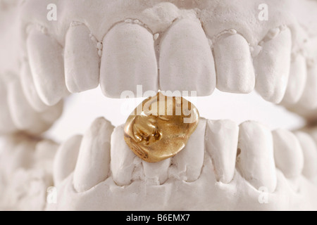 Plaster cast dental tooth imprint for making denture Stock Photo - Alamy