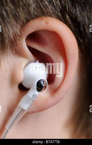 Close-up of the ear in a 2 year old female patient, showing melted wax ...