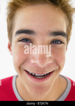 close portrait of Caucasian boy with braces and reassuring smile in ...