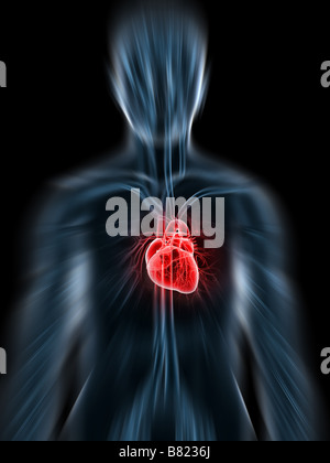 Illustration of an inflamed heart Stock Photo - Alamy