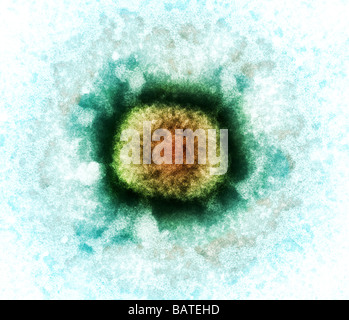 Color enhanced electron micrograph of a Vaccinia virus, This poxvirus ...