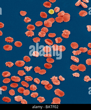 Crenated red blood cell. Coloured scanning electron micrograph (SEM) of ...