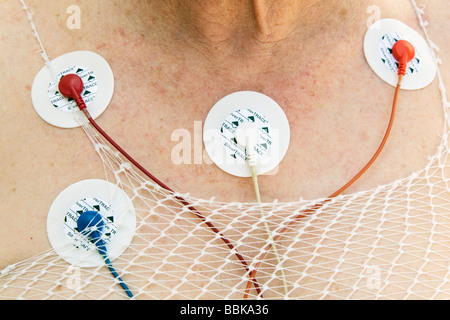 Portable heart monitor, Man wearing a portable electrocardiograph ...