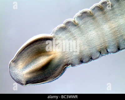 Tapeworm, light micrograph Stock Photo - Alamy
