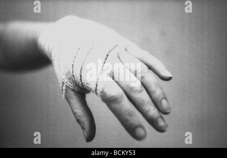 A bandaged hand Stock Photo - Alamy