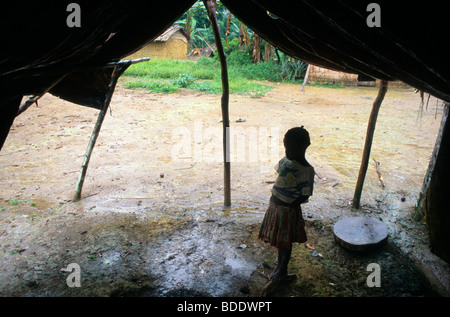 pygmy girl in a rainforest village with an injured eye, near Pokone in ...