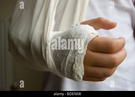 Child with Broken Arm Stock Photo - Alamy