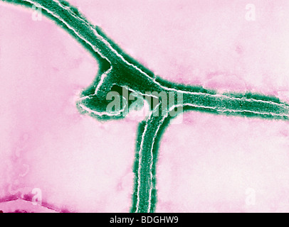 Marburg virus transmission electron microscope image colorized source ...