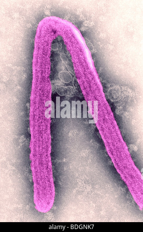 Marburg virus transmission electron microscope image colorized source ...