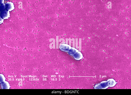 Scanning Electron micrograph (SEM) of Acinetobacter baumannii, This ...