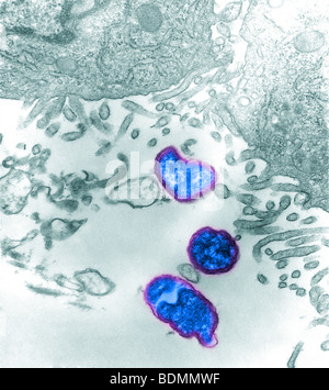 Transmission electron micrograph (TEM) of the gram-positive bacteria ...