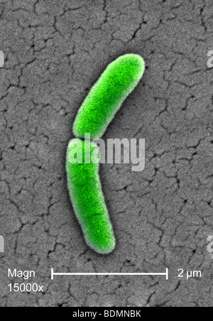 A scanning electron micrograph of Salmonella typhimurium DT 104 Stock ...
