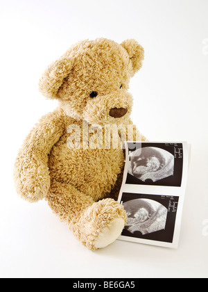 Teddy bear with ultrasonograms Stock Photo - Alamy