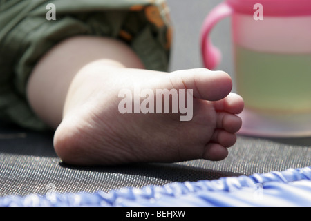 Down's Syndrome foot. Sole of the foot of a Down's syndrome infant ...