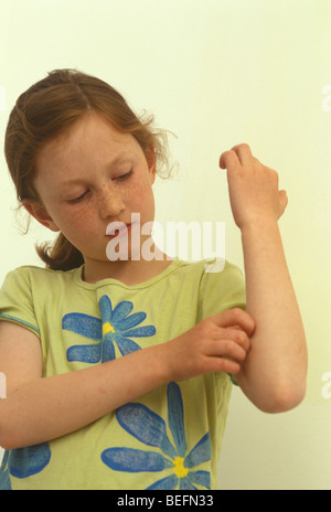 girl with eczema scratching Stock Photo - Alamy