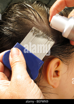 Nit comb, A mother combing her daughters hair with a nit comb Stock ...