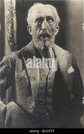 Bug eyed man Stock Photo - Alamy