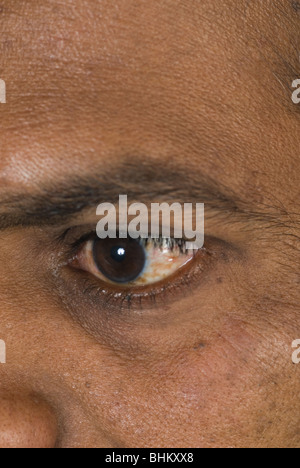 Man is thinking intensely Stock Photo - Alamy