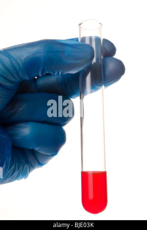 Gloved hand holding a blood sample tube labeled Lyme Positive Stock ...
