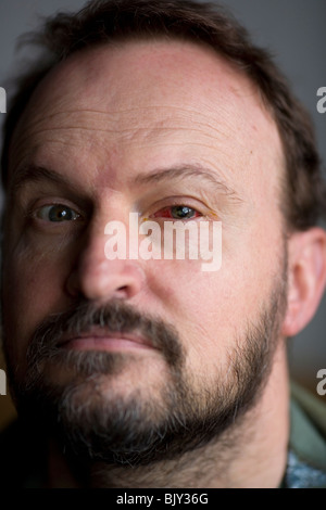 Portrait of an middle-aged man with swollen inflamed left eye due to a ...