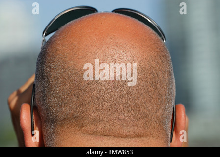 Back of bald man's head Stock Photo - Alamy