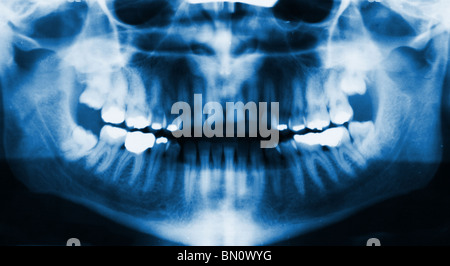 Human anatomy skeleton. Detail of face,cheek bone. Bone structure ...