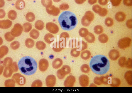 Human blood smear, light micrograph Stock Photo - Alamy