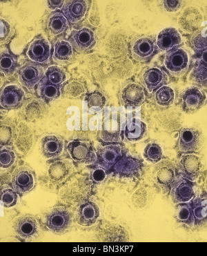 Negatively-stained transmission electron micrograph (TEM) of Rubella ...