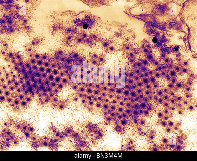 Transmission electron micrograph (TEM) of Reovirus type-3 Stock Photo ...