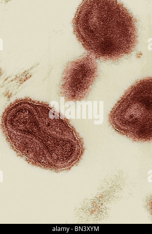 A transmission electron micrograph (TEM) of smallpox viruses using a ...