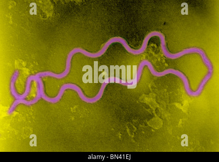 An electron photomicrograph of two spiral-shaped Treponema pallidum ...