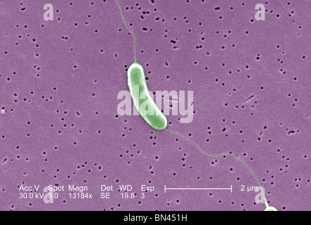 Scanning electron micrograph (SEM) of Vibrio cholerae bacteria, This ...