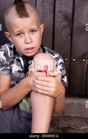 Young injured boy with bleeding knee sitting down outside Stock Photo ...