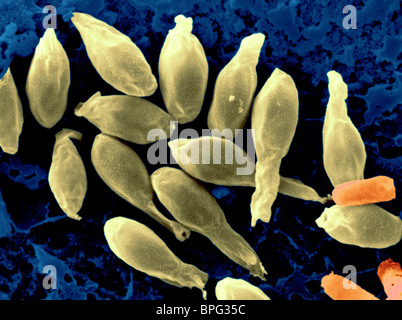 Gram-positive Clostridium difficile bacteria revealed in the stool ...