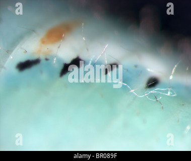 Microscopic view of a caterpillar Stock Photo - Alamy