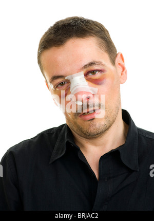 man with broken, crooked nose and black, crossed eyes, isolated on ...