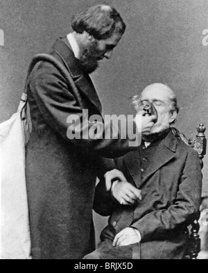 JOSEPH CLOVER (1825-1882) English doctor who pioneered anaesthesia ...