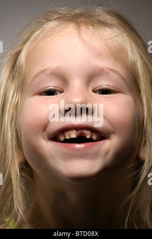 Funny little girl without tooth smiles showing gap close up Stock Photo ...
