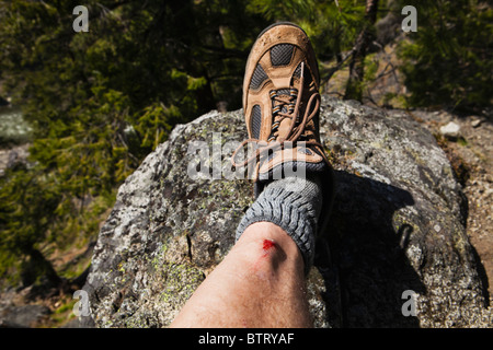 The wound on man's leg Stock Photo - Alamy