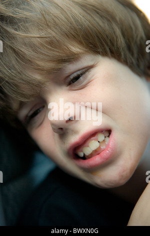 Close-up of the ear in a 2 year old female patient, showing melted wax ...