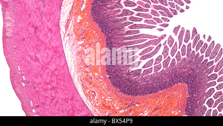 Small intestine. Light micrograph of a section through the finger-like ...